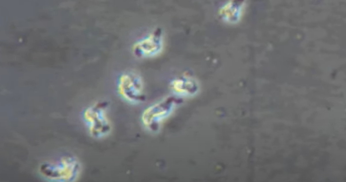 Ameba mangia-cervello, allarme in Italia: "Come si può contrarre", tasso di letalità al 95% ...